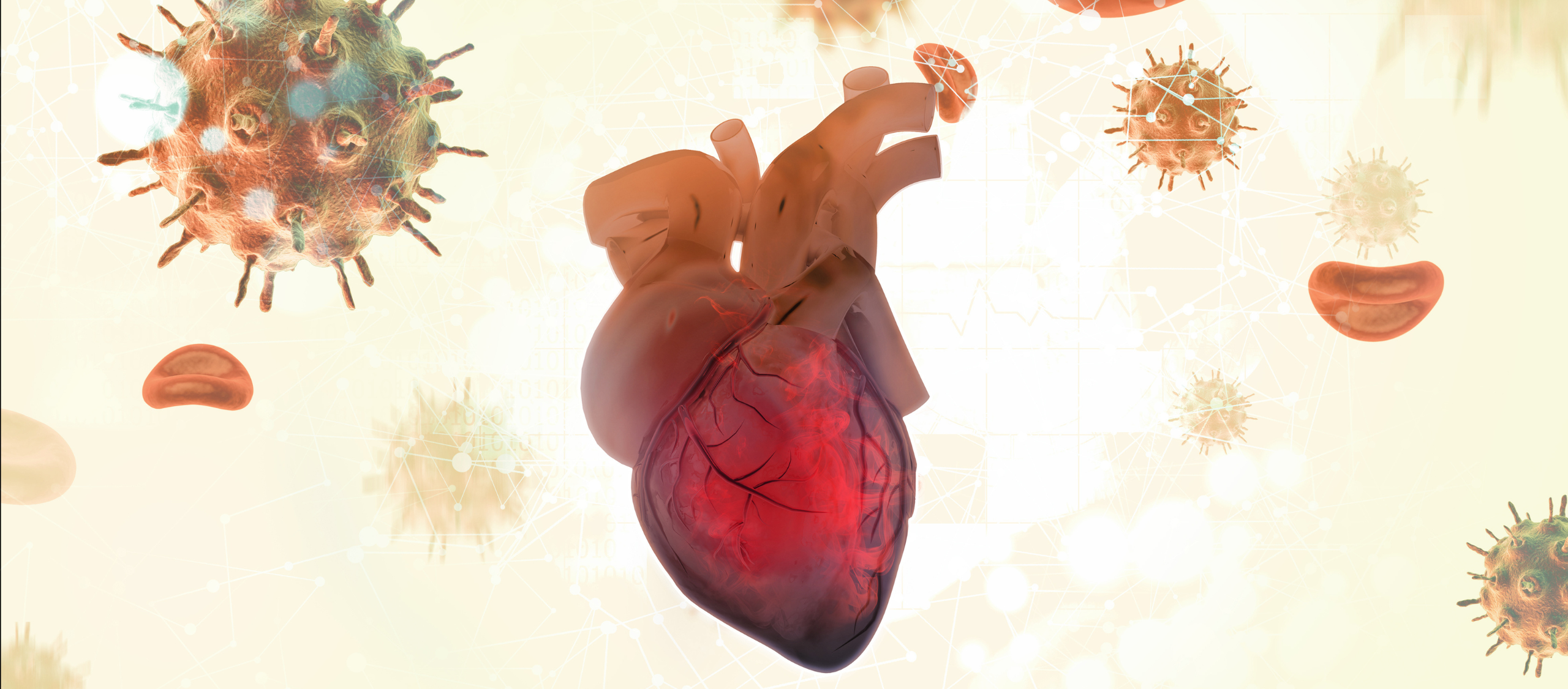 Endocarditis Infecciosa
